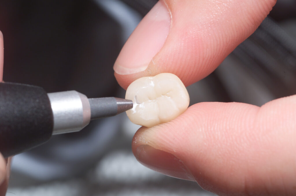 Vario basic Renfert - AMED